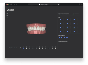 Orthodontie par aligneurs Made in France I Aligneurs Français