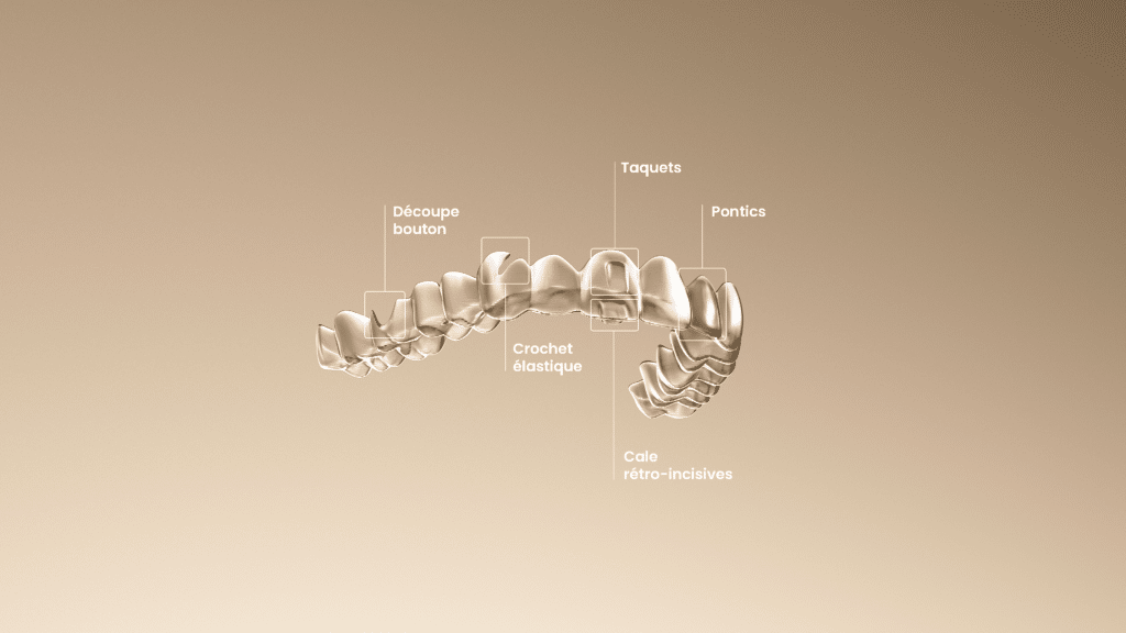 Nos aligneurs invisibles I Aligneurs Français