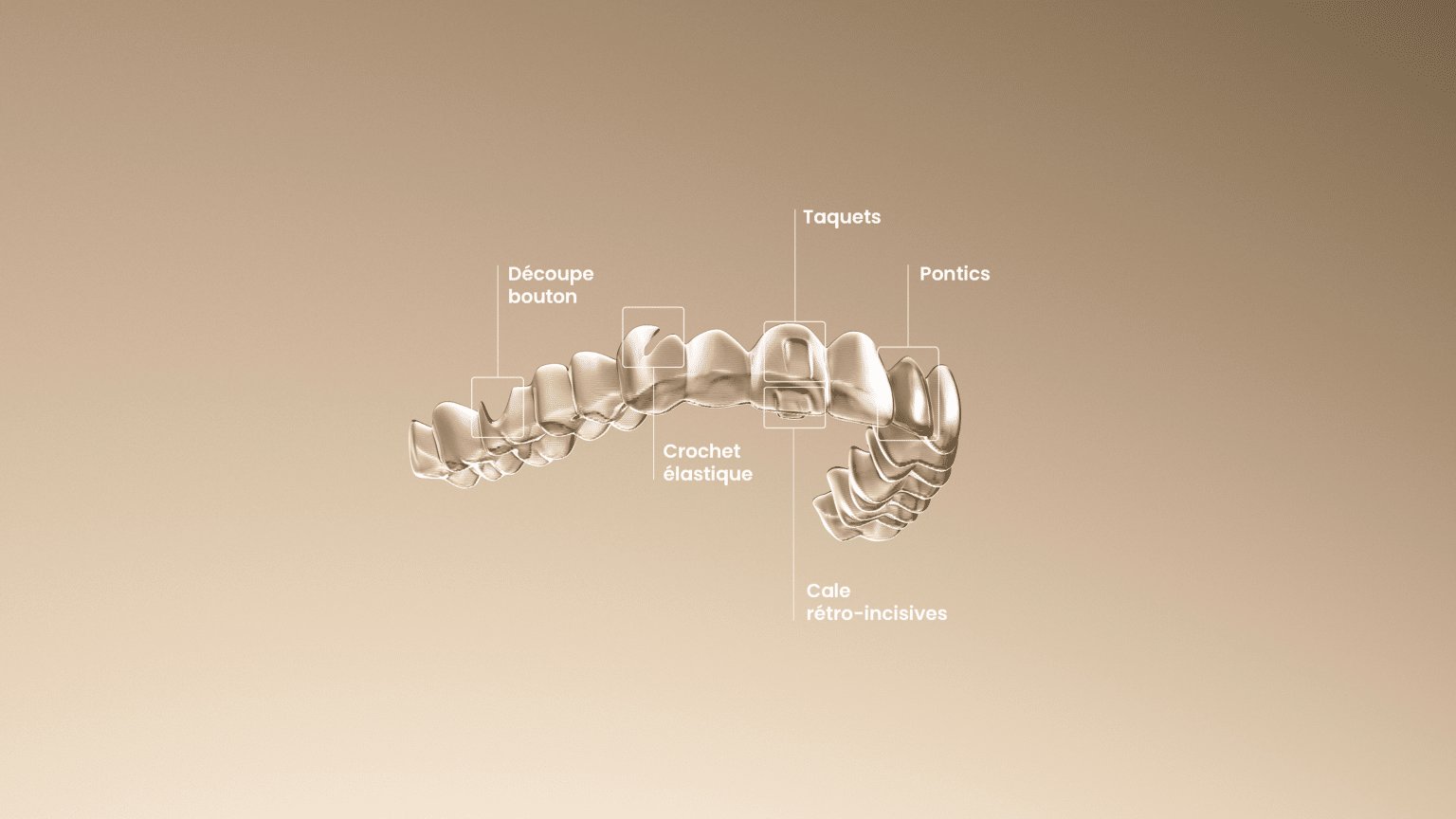 Nos aligneurs invisibles I Aligneurs Français