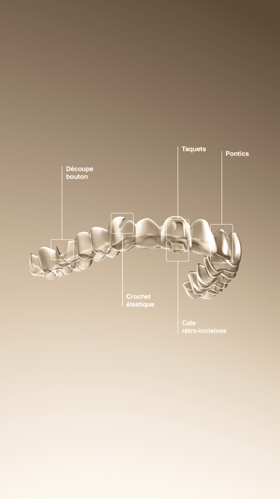 Nos aligneurs invisibles I Aligneurs Français