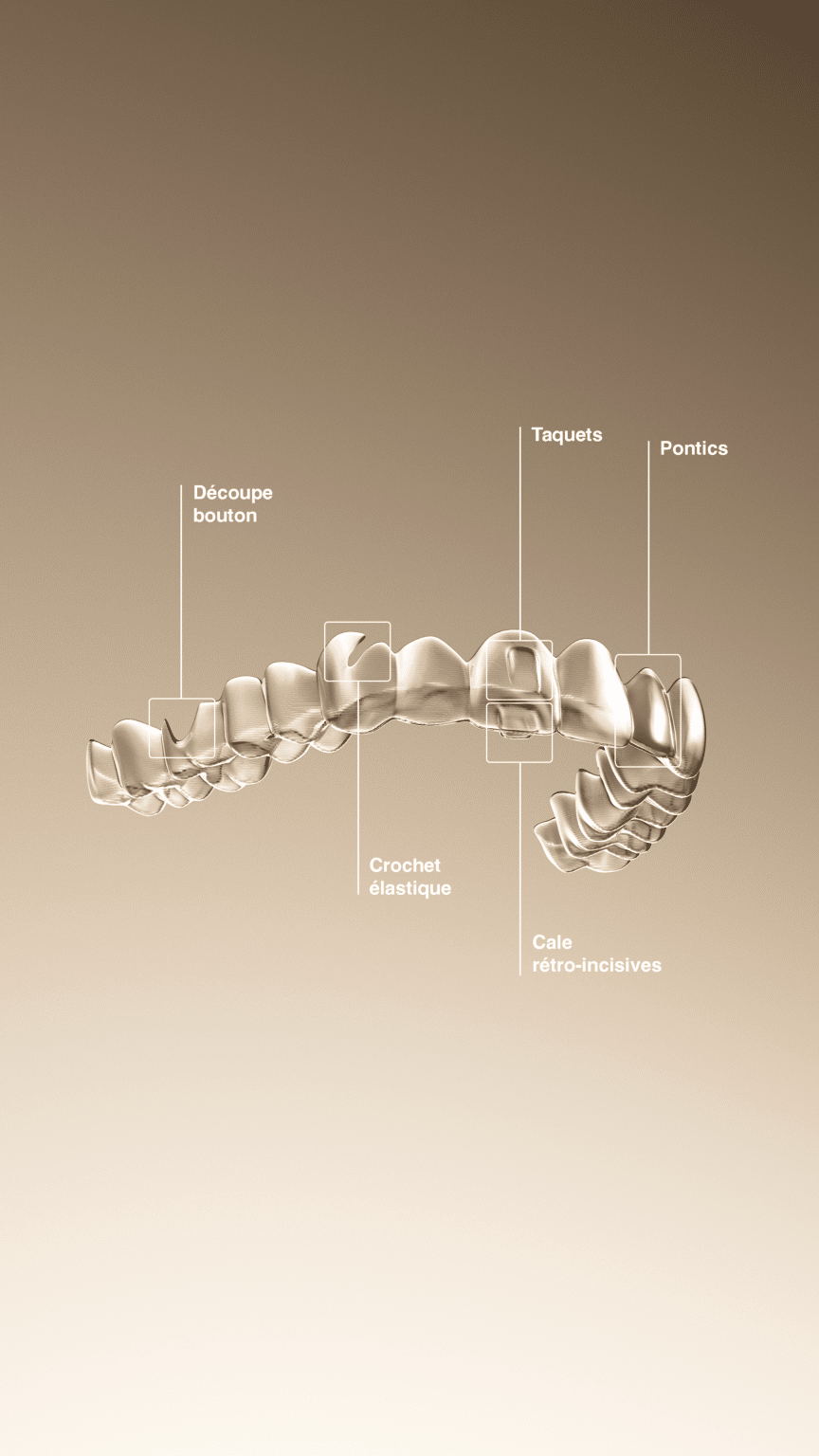 Nos aligneurs invisibles I Aligneurs Français